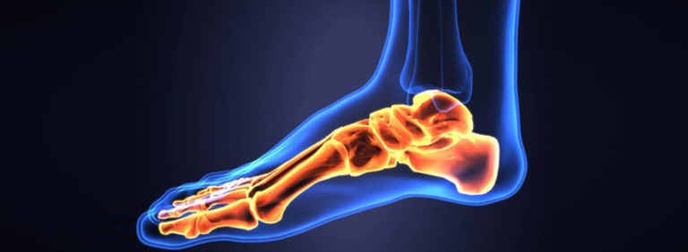 Anatomía del hueso calcáneo y ángulos de fractura - MBA Blog